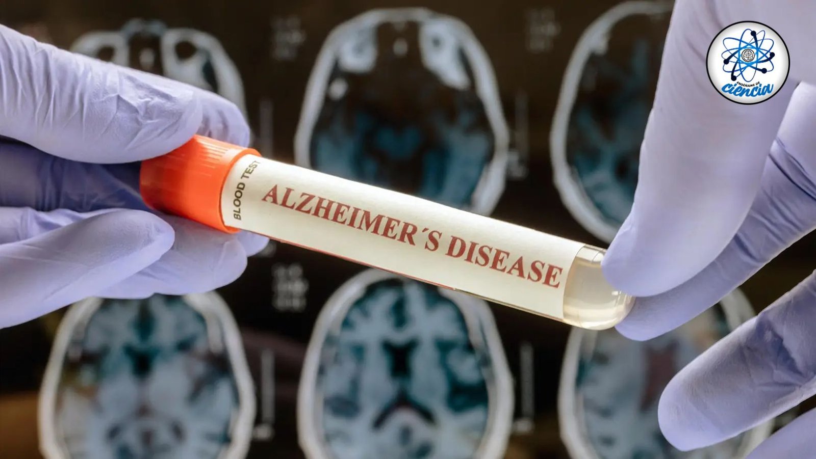 Descubren una prueba de sangre revolucionaria para la detección ...